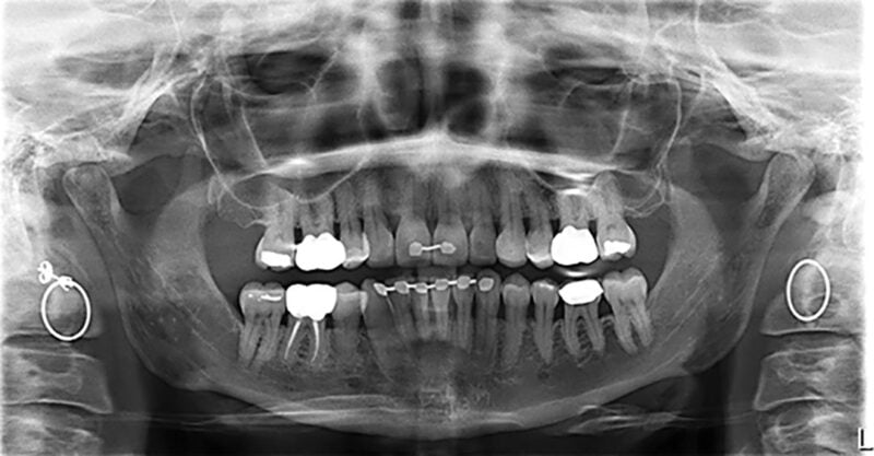 Featured Case Study in Compendium - Eau Claire Park Dental